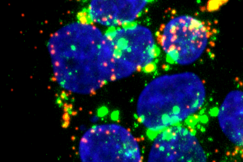 New cellular target prevents hepatitis E infection | Newsportal - Ruhr ...